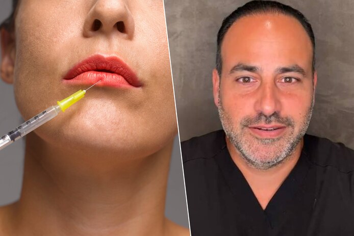 Plastisch chirurg doet opvallende onthulling: “Stakende acteurs gaan ...