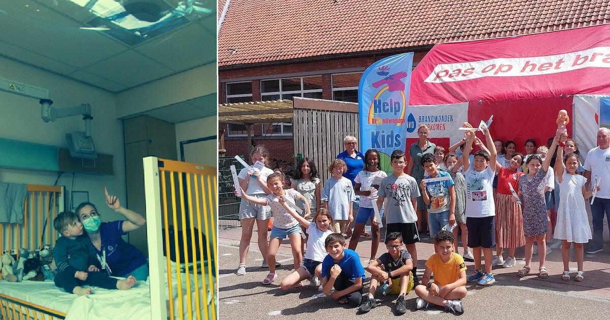 Help Brandwonden Kids zamelt geld in voor visuele ontspanningsapparaten ...
