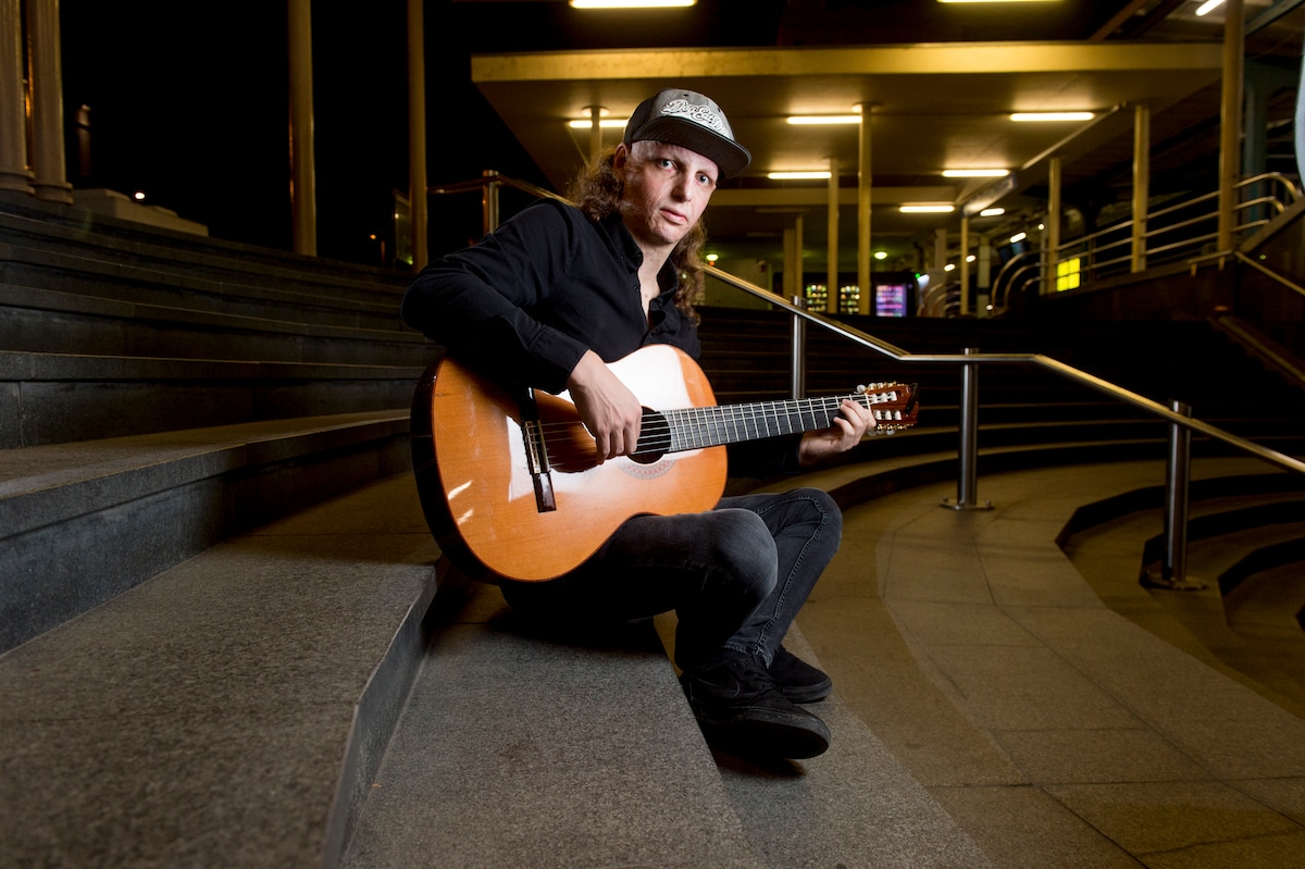 Twintiger toont zijn brandwonden voor bomvolle opera: "Zeg mij eens ...