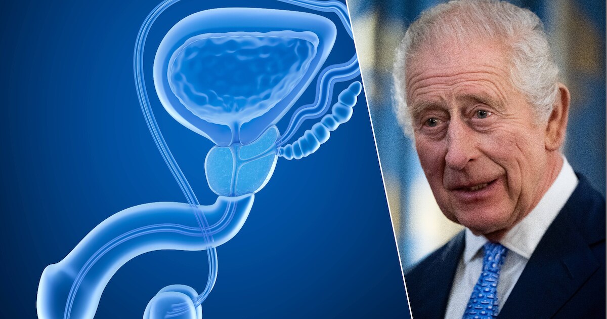 “Je kan het hebben zonder het te weten”: koning Charles heeft een ...