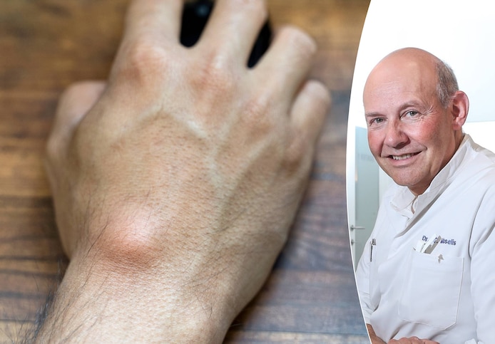 Voel je plots een vetbolletje onder je huid? Dan kan dat een lipoom ...