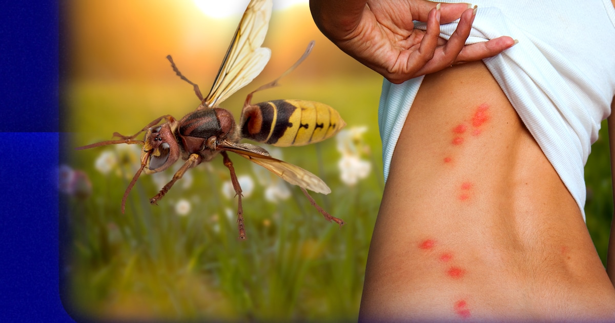 Arts tipt wat (niet) helpt bij insectenbeten: “Zo kan je de pijn en ...
