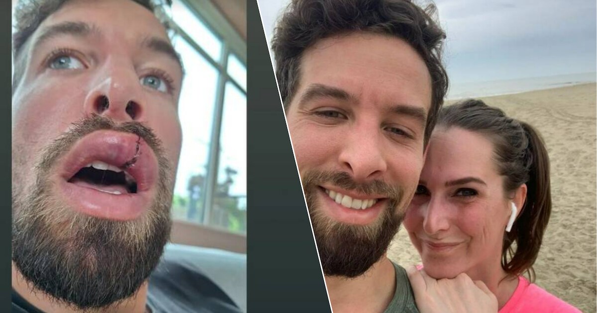 Ex-topzwemmer Pieter Timmers en zijn vrouw Elle werkonbekwaam geslagen ...