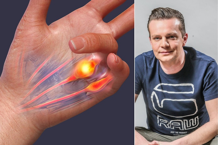 Wat is de ziekte van Dupuytren, waar ook Jimmy van Get Ready aan lijdt ...
