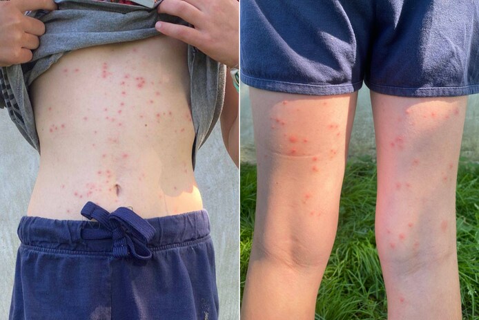 “Het is verschrikkelijk, je kan het je niet voorstellen”: Bart (65) en ...