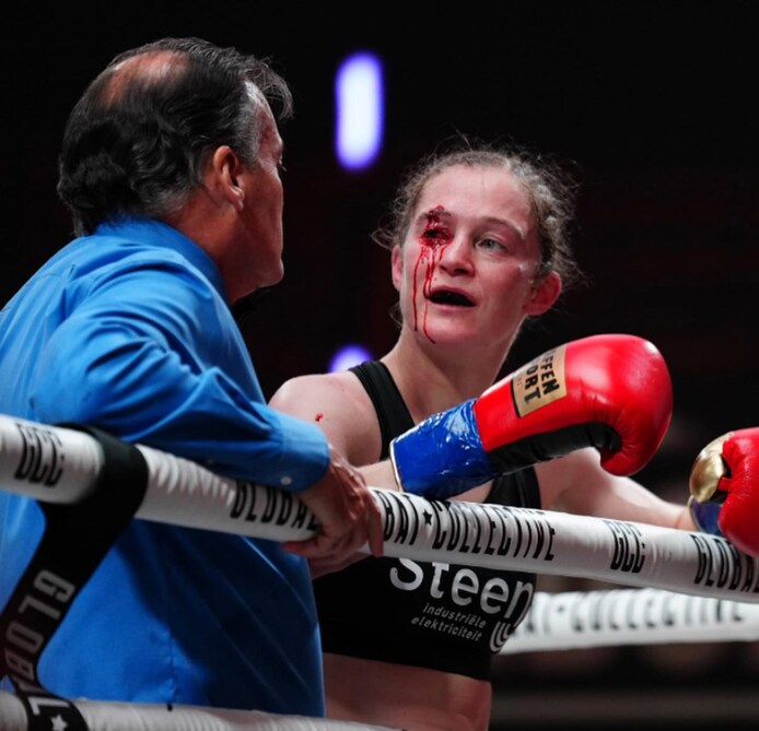 “Ineens zat ik op mijn gat”: hoe Delfine Persoon met kapotte ...