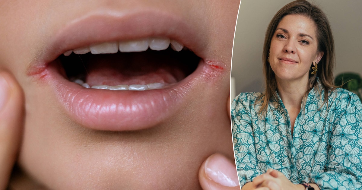 “Kunstgebit of beugel? Dan loop je meer risico”: deze 2 dingen kan je volgens huisarts doen aan ...