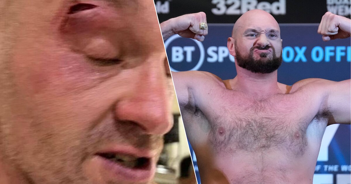 "Hij is een f*cking lafaard": kamp-Usyk woest op Fury, die lelijke ...