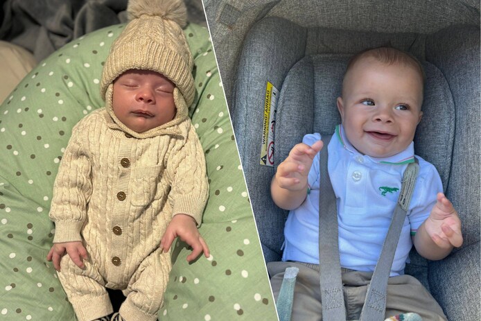 Lewis (tien maanden) werd geboren met afwijkende handjes en voetjes ...