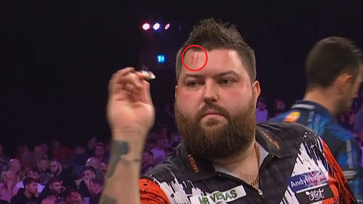 Een bizar beeld: ex-wereldkampioen darts Michael Smith verwondt zichzelf met zijn pijltjes en ...