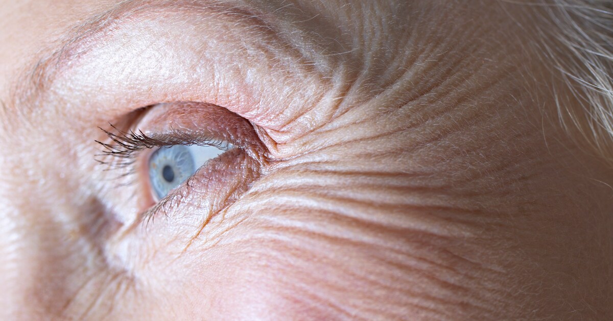 Ja, je kan sommige rimpels ongedaan maken: “Na amper een week smeren ...