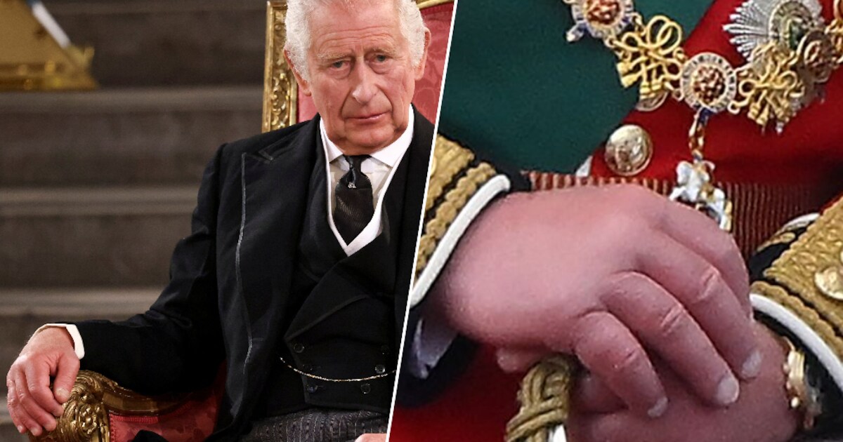 Heeft koning Charles hartproblemen? Bezorgdheid over gezwollen vingers ...