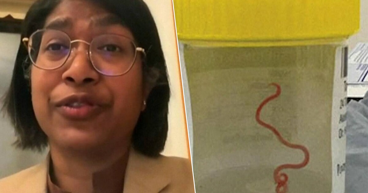 KIJK. “Ik was in shock toen ik zag dat het wiebelde”: neurochirurge ...