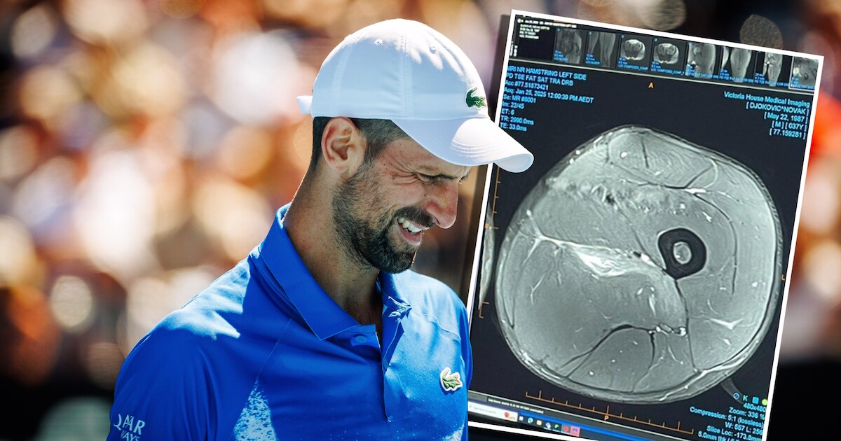 De aanhoudende twijfels spuugzat: uitgefloten Novak Djokovic deelt MRI ...