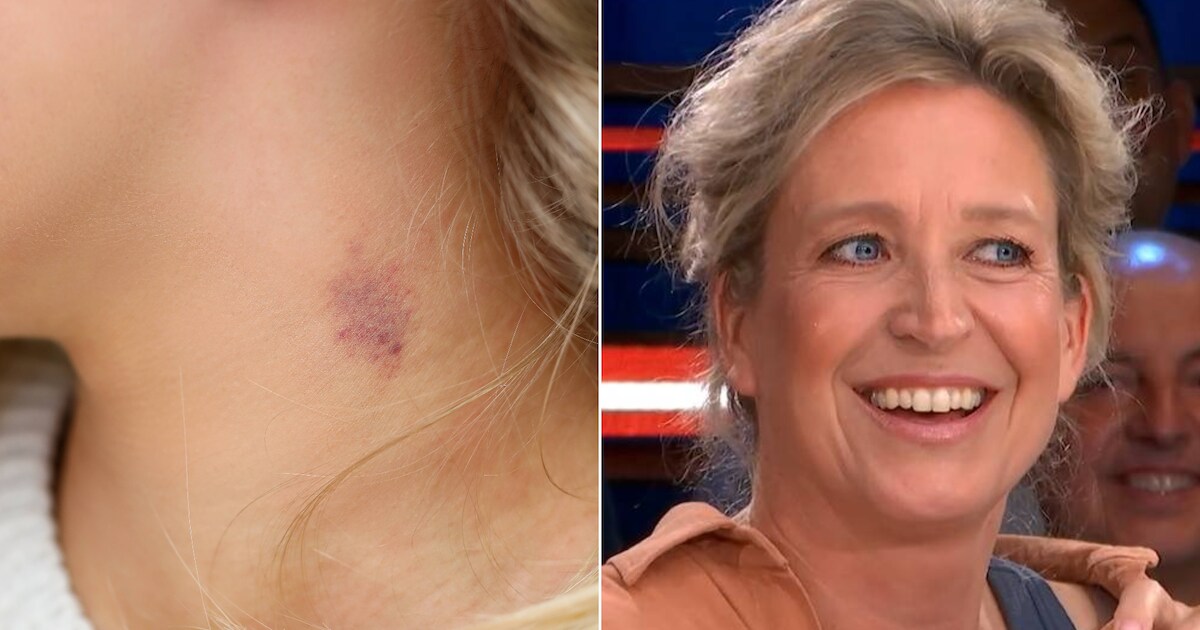 Is een passionele zuigzoen écht zo gevaarlijk als Cath Luyten beweert ...