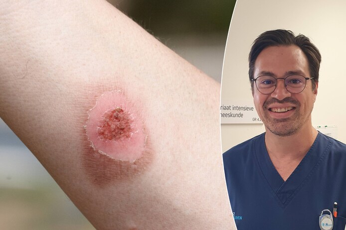 Het begint met klein wondje, maar kan snel escaleren: wat is de ...
