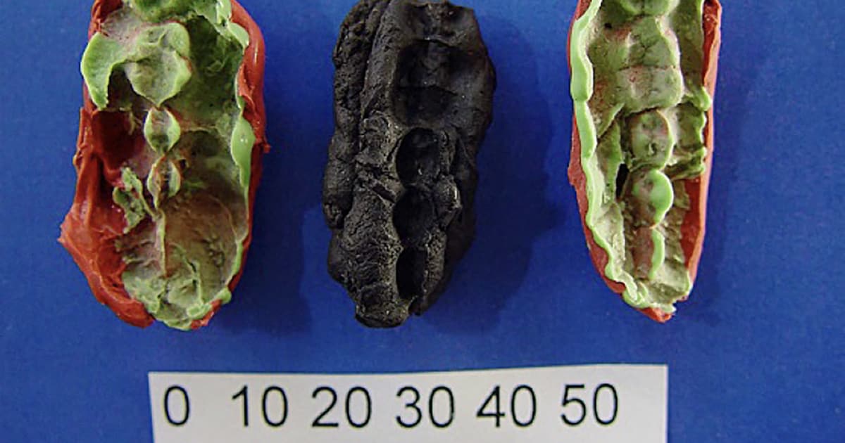 Prehistorische ‘kauwgom’ werpt licht op wat tieners uit stenen tijdperk ...