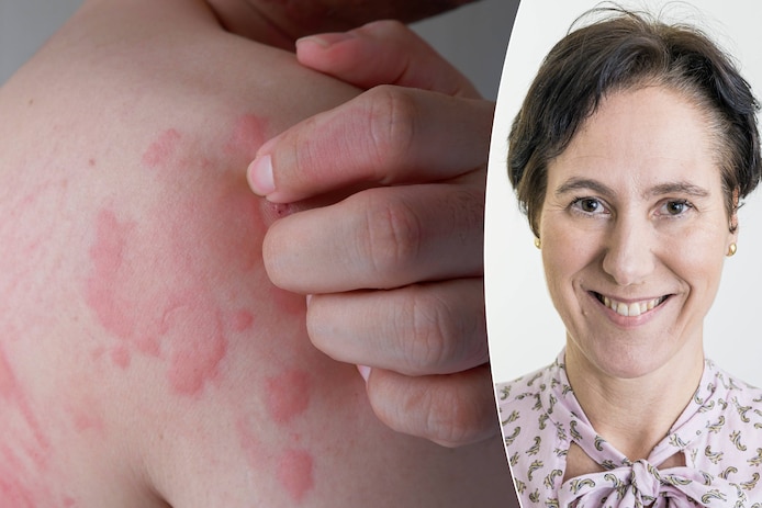 Last van rode vlekken die plots opduiken en weer verdwijnen ...