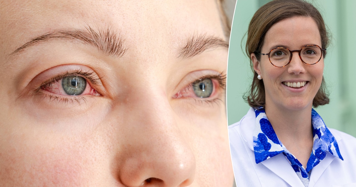 Last van rode ogen? In deze gevallen ga je er best mee naar de dokter ...