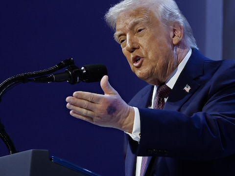 Nieuwe blauwe plekken bij Trump, president wuift zorgen weg: “Ik heb ...