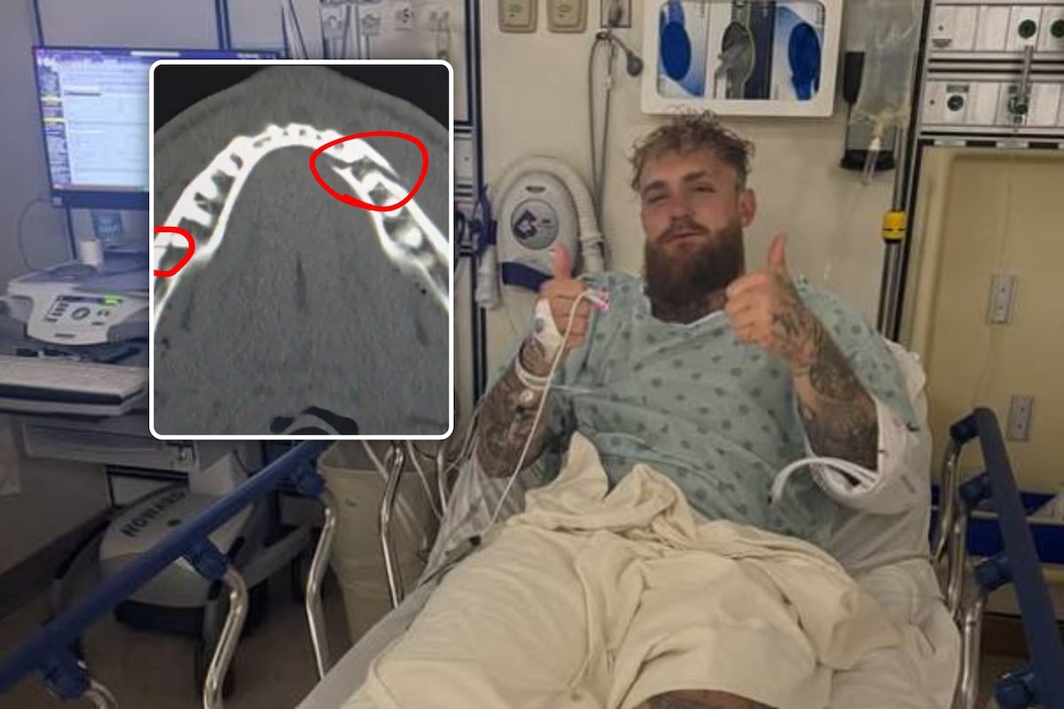 Één dag na de operatie: slecht nieuws rond Jake Paul – ‘Hij kreeg ...