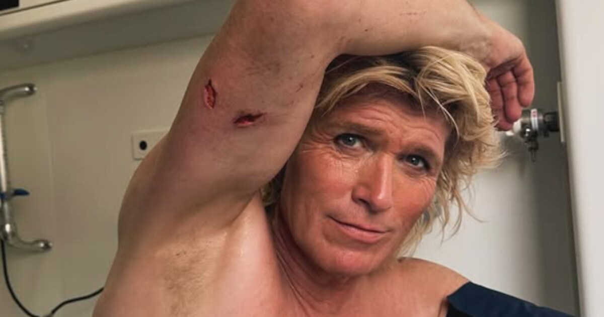 Gewonde Hans Klok negeert adviezen en doet opnieuw gevaarlijke sabelact | Showbizz | hln.be