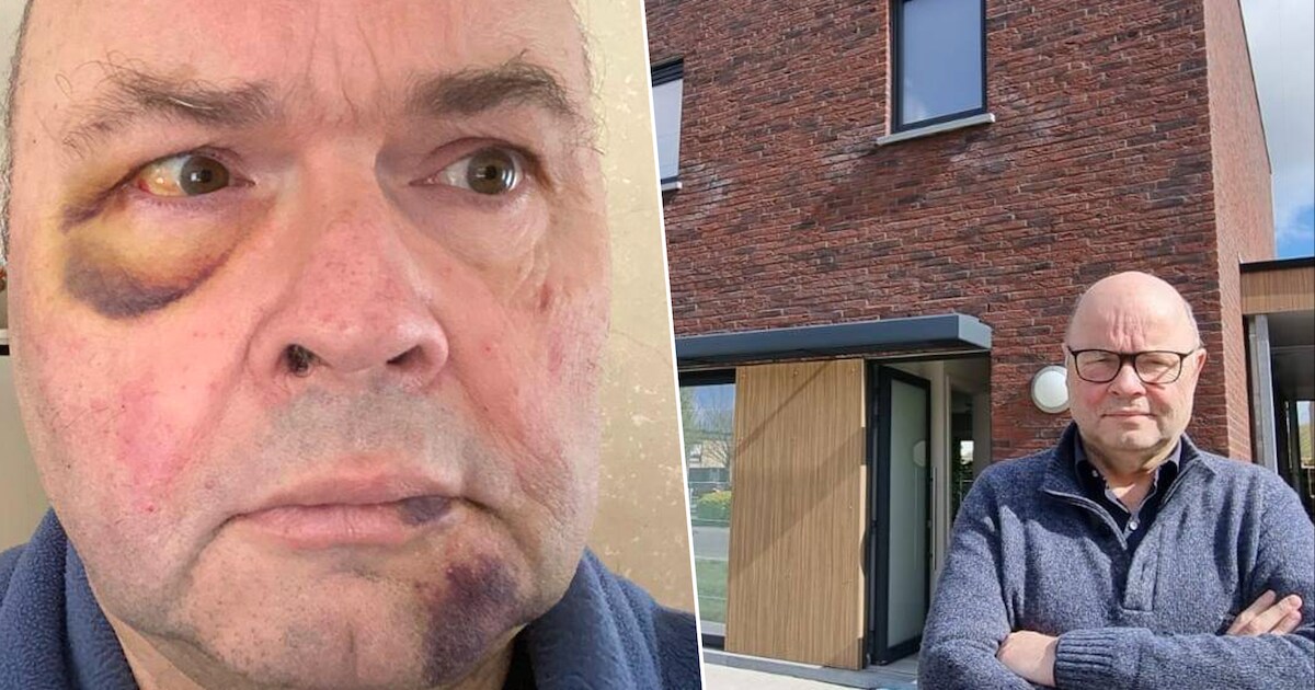Gebroken oogkas en hersenschudding geslagen na opmerking over spelende ...