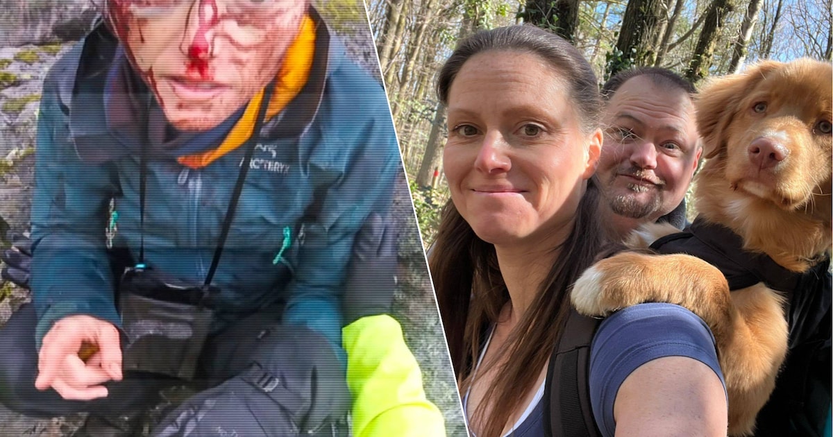 Zij had een open schedelbreuk, hij belandde vijf dagen in coma: Dimitri ...