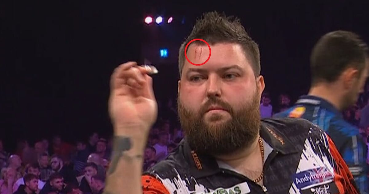 Een bizar beeld: ex-wereldkampioen darts Michael Smith verwondt ...
