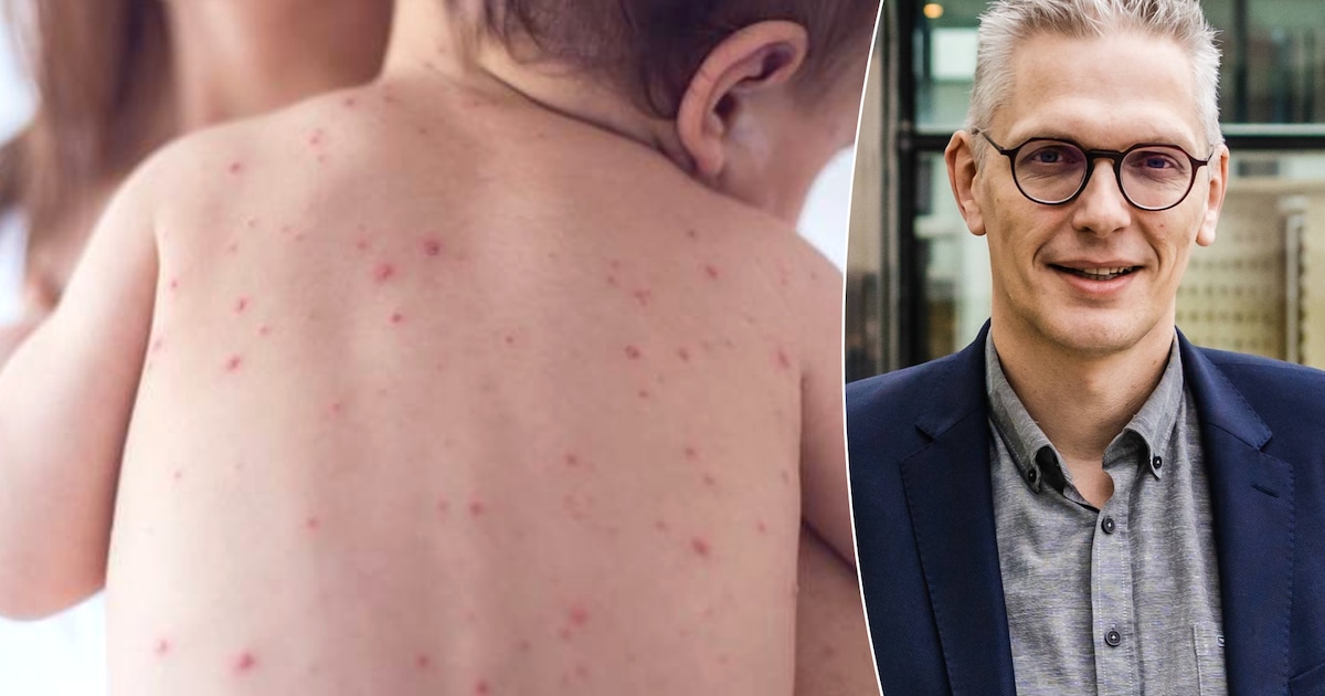 Waarom steken kinderziektes zoals mazelen weer de kop op? “Niet ...