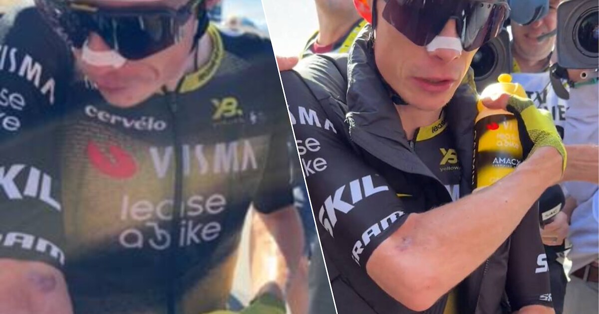 Jonas Vingegaard wordt na finish op Ventoux ten val gebracht door ...