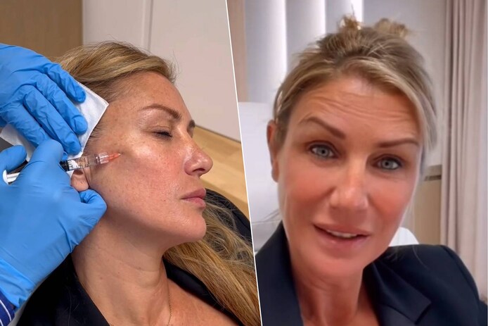 KIJK. Debby Pfaff toont met welke cosmetische ingreep ze haar buik en ...