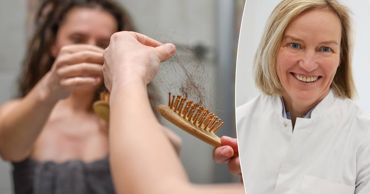Haaruitval door frisdrank en alcohol? Dermatologen reageren op nieuwe ...