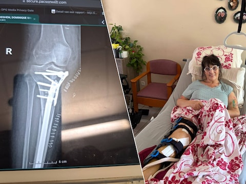 Dominique (61) keek uit naar festivalzomer, maar belandt na ongeval met ...