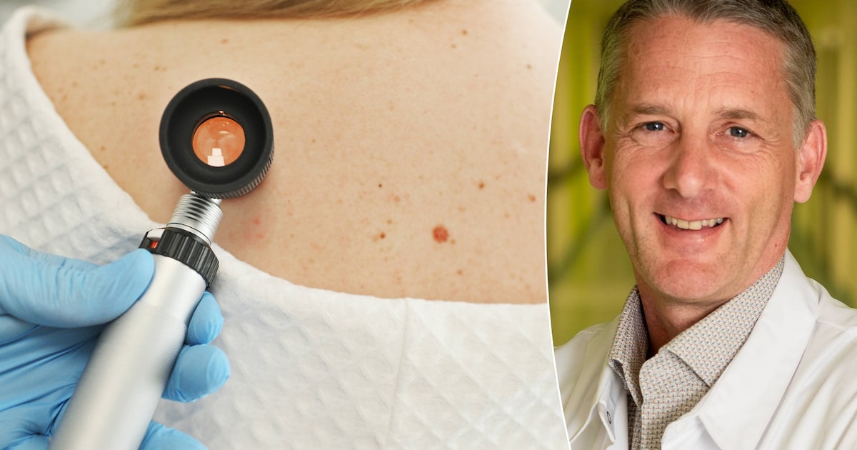 Voor het eerst veelbelovende therapie tegen uitgezaaide huidkanker ...