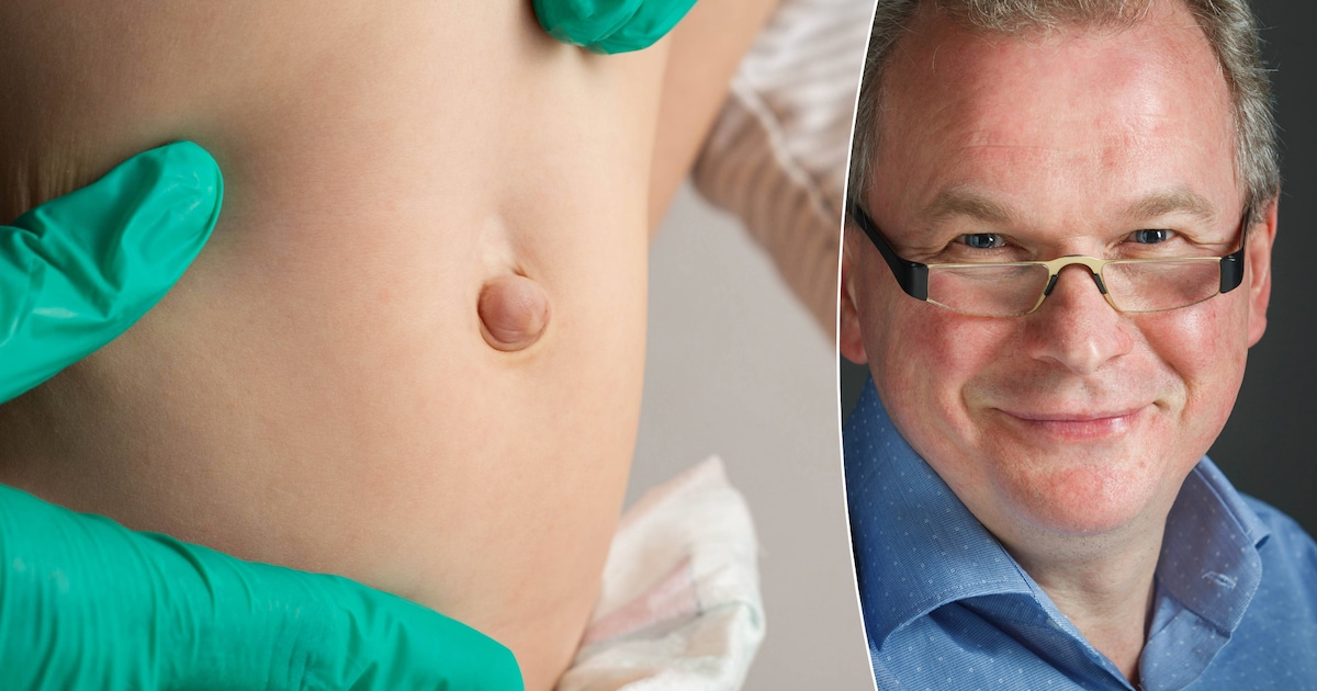 Bultje op je buik? Misschien is het een navelbreuk: “Veel mensen voelen ...