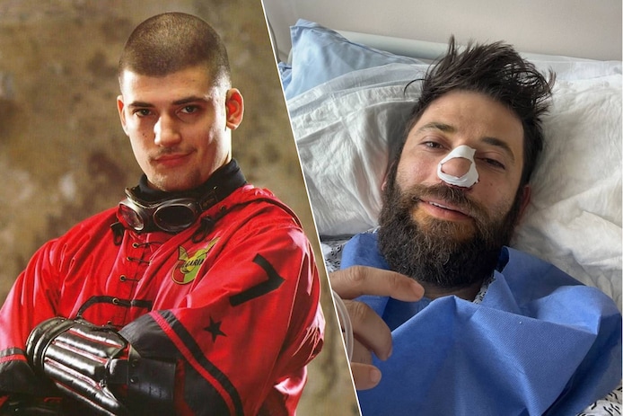 ‘Harry Potter’-acteur met spoed geopereerd: “Ik kon amper nog ademen” | TV | hln.be