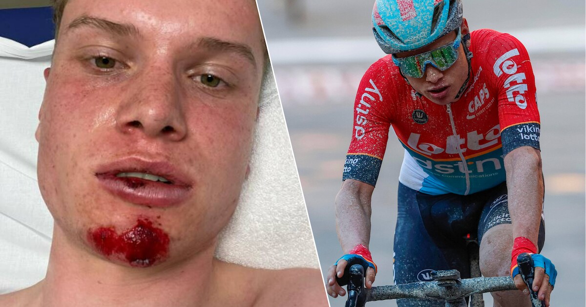 “Blij dat ik nog leef”: Lotto-renner Lennert Van Eetvelt zwaar gehavend na aanrijding door auto ...