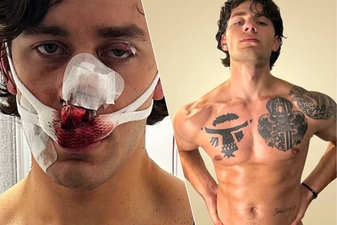 “Duitsland, hebben jullie nog wel wetten?”: Amerikaans model (21 ...