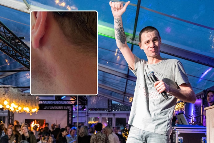 Sam Gooris reageert boos nadat hij blauwe plekken oploopt tijdens optreden: “Van harte bedankt ...