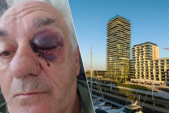 Eddy (63) slachtoffer van zinloos geweld in Oostende: "Dit heb ik in al ...