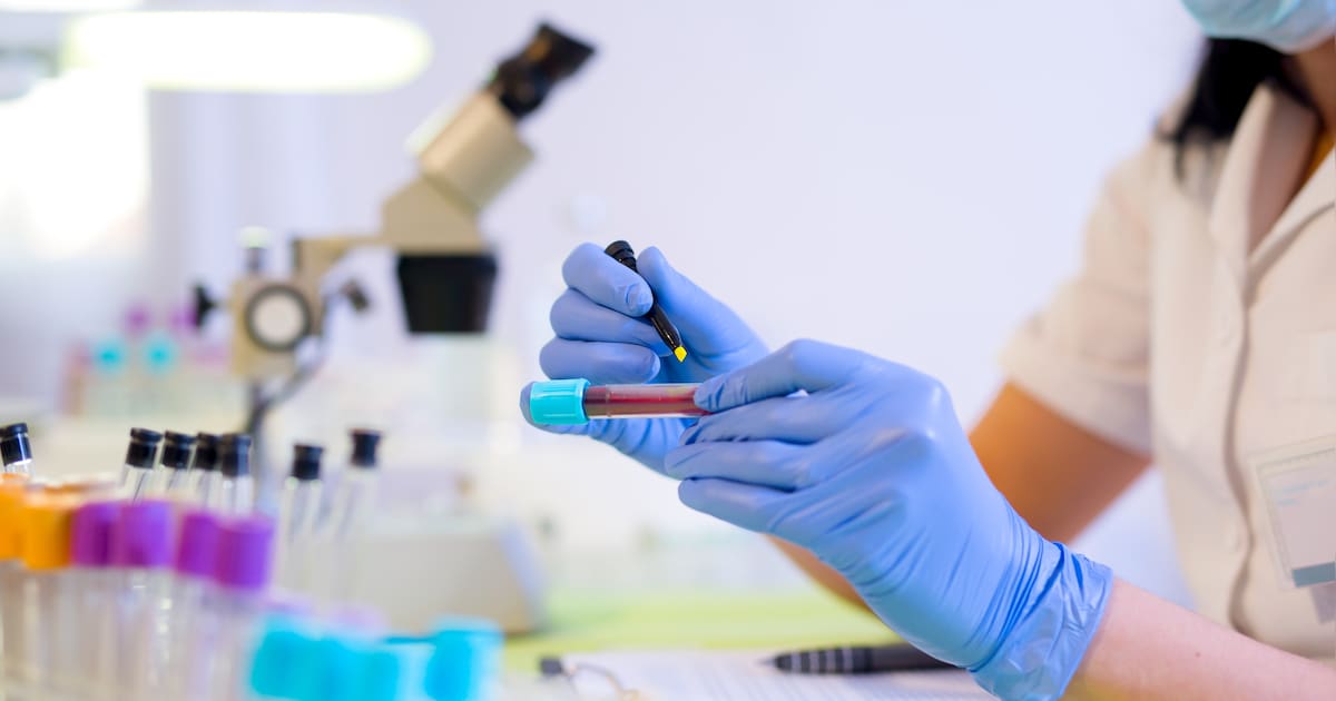 Doorbraak in onderzoek naar pancreaskanker dankzij studie VUB | Weer ...