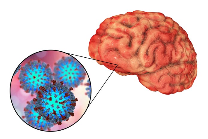 Nu mazelen weer in opmars zijn: hoe gevaarlijk is de ziekte? En wat ...