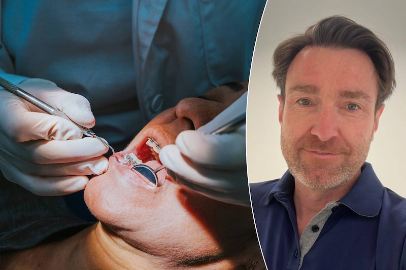Heel wat Belgen beugelen al voor een 2de keer: orthodontist legt uit ...