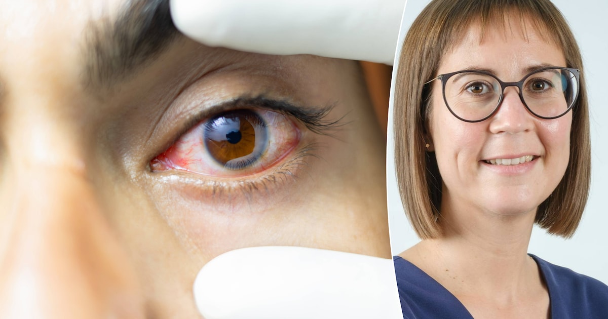 Kan een oogtest voorspellen wie dement zal worden? | Gezondheid | HLN.be