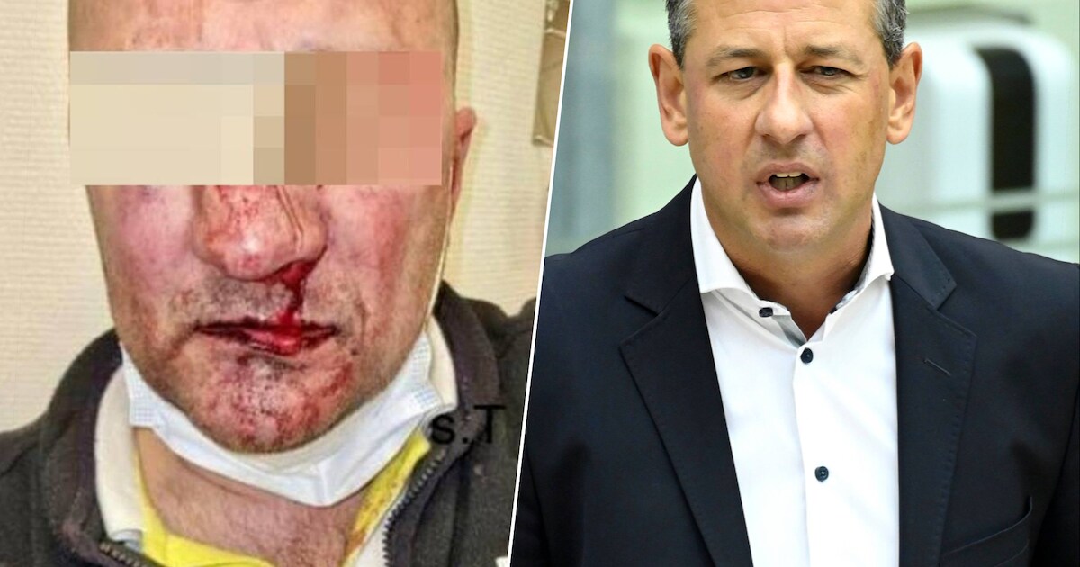 Buschauffeurs leggen werk neer na zware agressie in Genk: “Laat hen ...