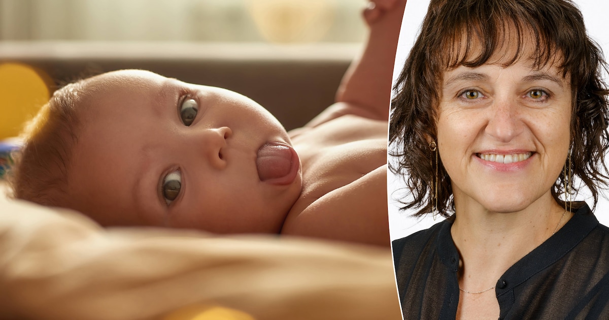 Heeft je baby een grote tong? Arts over het Beckwith-Wiedemann Syndroom ...