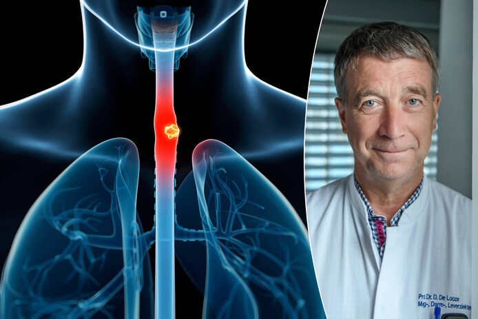 “Als je er ’s nachts van wakker wordt, heb je écht een probleem”: wat ...