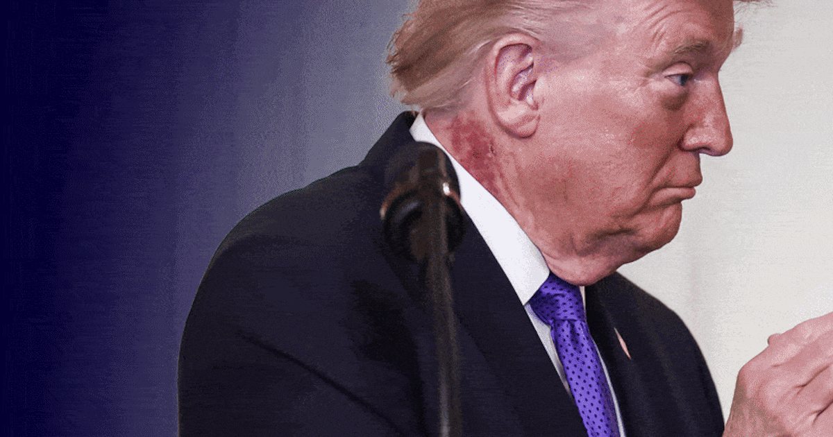 Waarom heeft Donald Trump een rode plek in zijn nek? Witte Huis komt ...