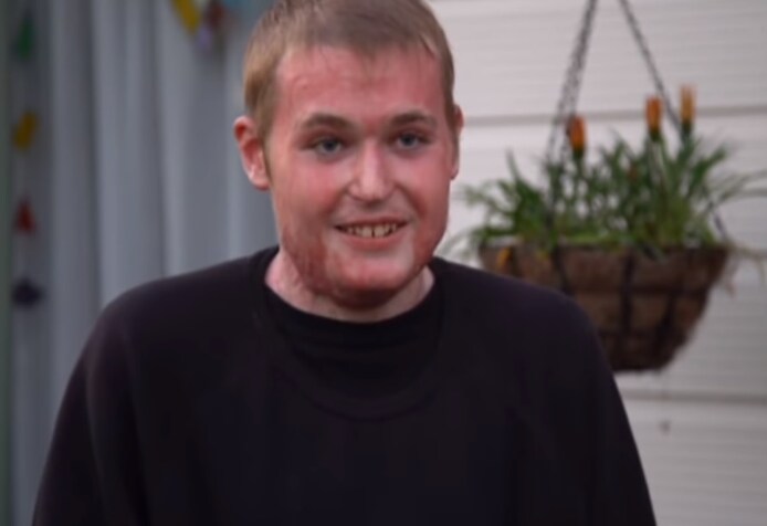 Jake (19) overleefde vulkaanuitbarsting : “Het heeft de manier ...